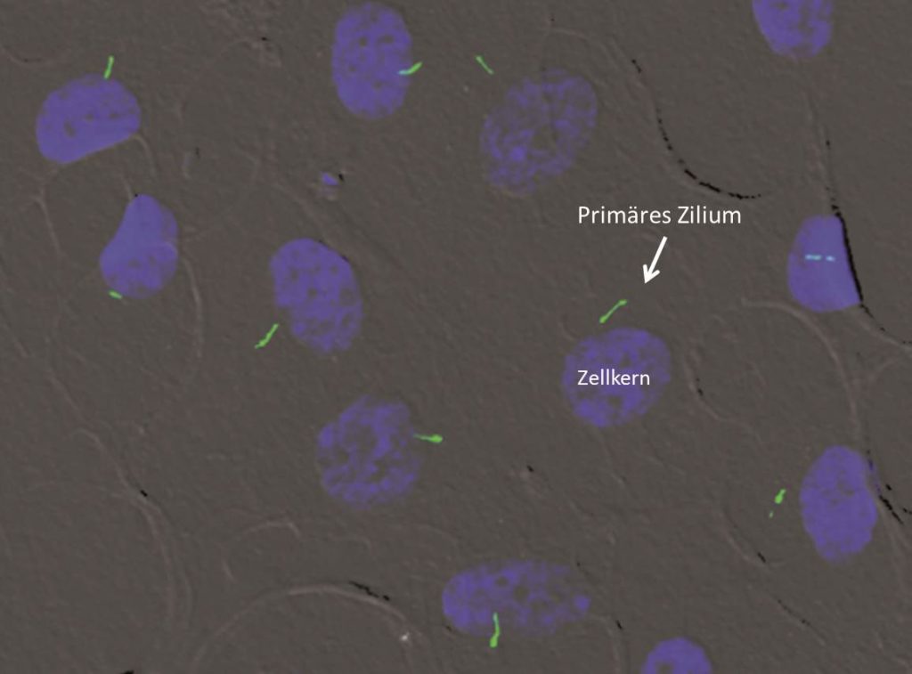 Von Zilien und Zysten – NEOCYST